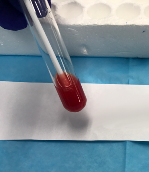 ROM Plus® Rupture of Membrane Test Family of Products - Laborie