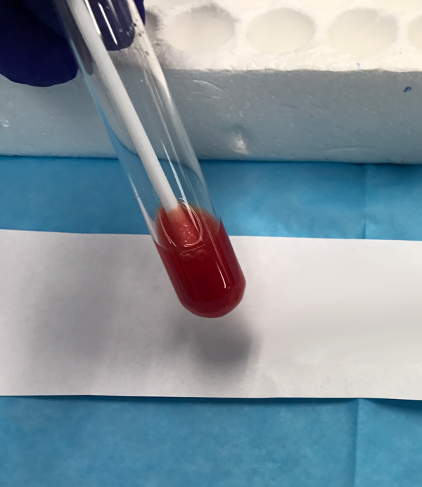 ROM Plus® Rupture of Membrane Test Family of Products - Laborie