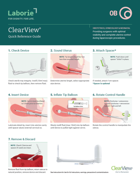 ClearView® Uterine Manipulator - Laborie