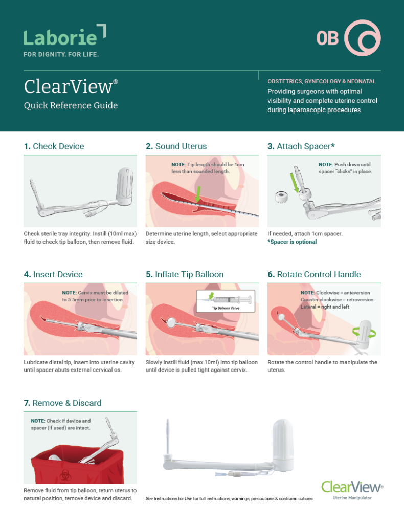 ClearView® Uterine Manipulator - Laborie