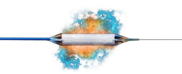 Optilume® | Urethral Drug Coated Balloon