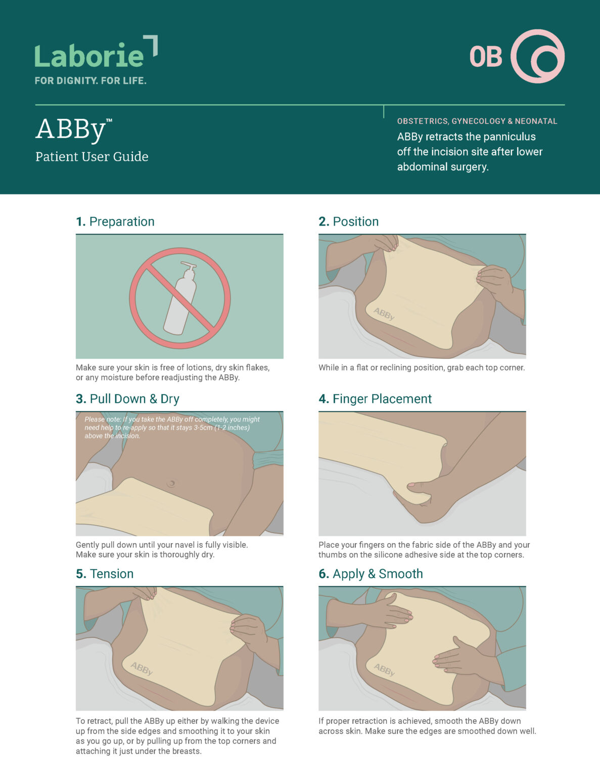 ABBy™ Postoperative Panniculus Retractor - Laborie